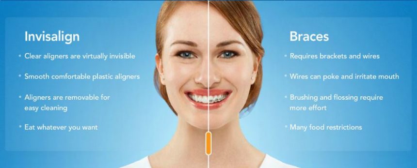 why_invisalign - Crosspoint Dentistry
